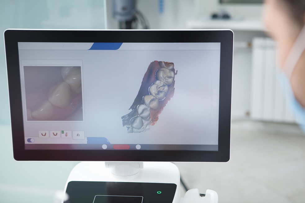 Digital Dentistry: What is Intraoral Scanner? - The Willows Dental Surgery
